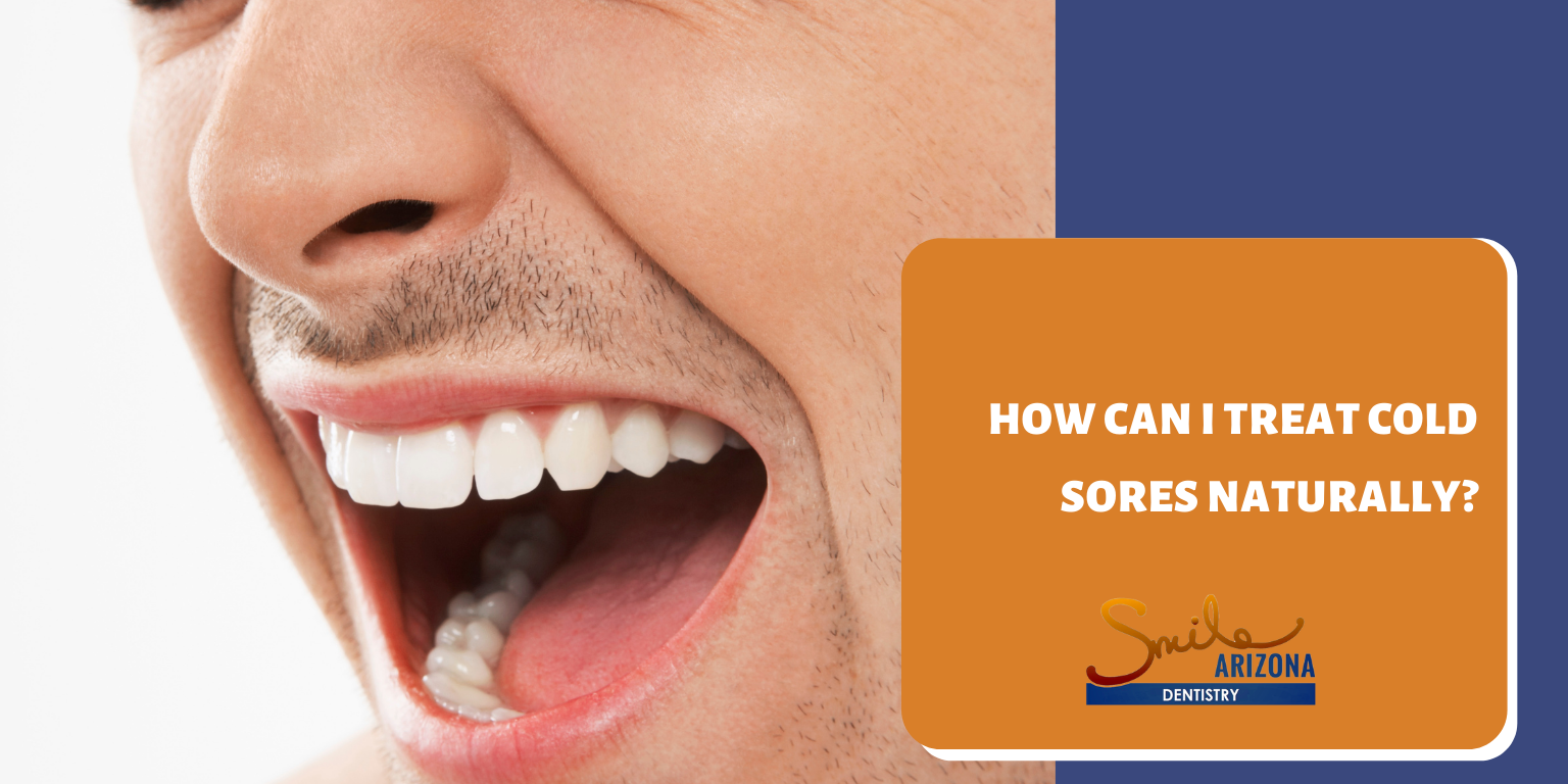 How Can I Treat Cold Sores Naturally How Can I Treat Cold Sores Naturally