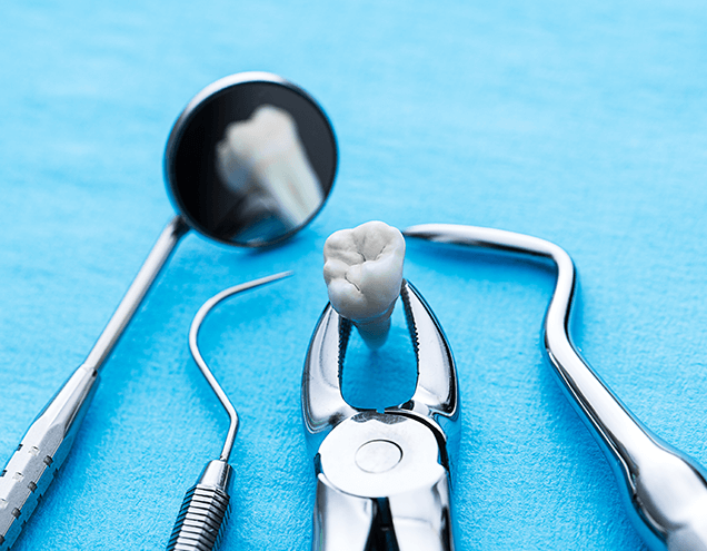 Emergency Tooth Extraction | Tooth Removal Near Me | Smile Arizona ...